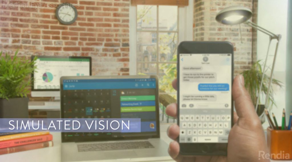 simulated vision through cataract - Medical Eye Associates